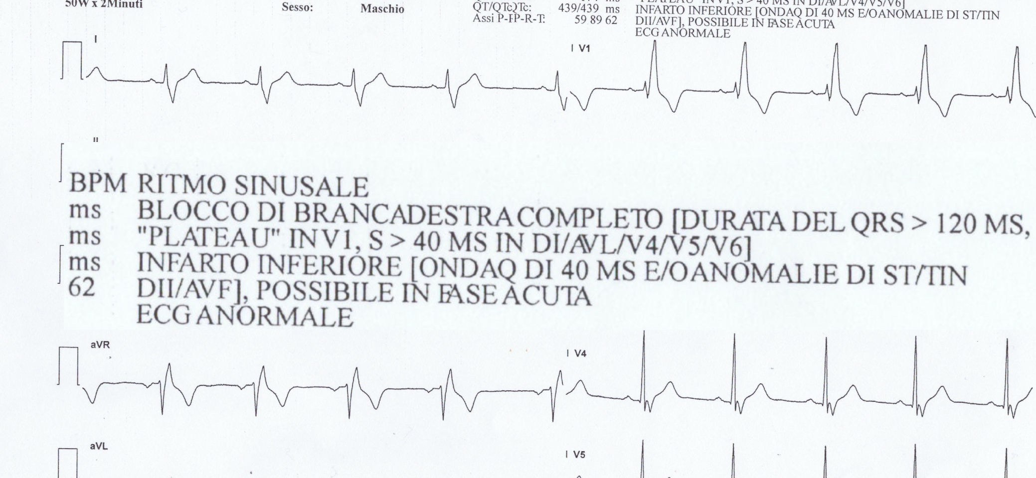 ECG SEMPLICE ECM PROFESSIONAL